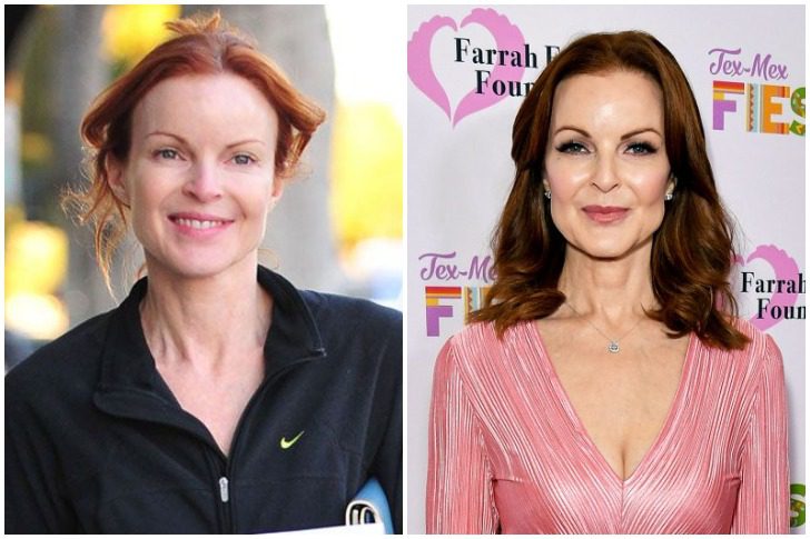 80 Celebrities Who Literally Prove That Beauty Is Skin Deep – Page 3 ...